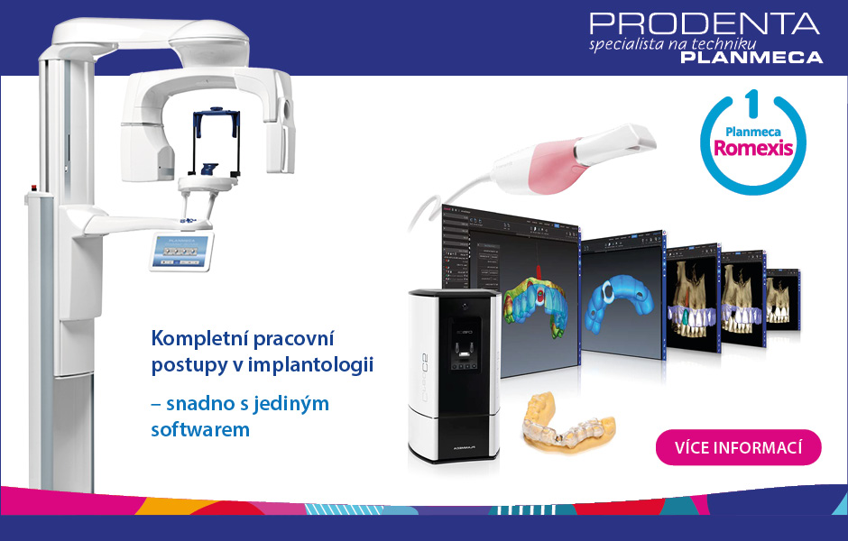 Řízená implantologie za použití řešení Planmeca all-in-one | StomaTeam ...