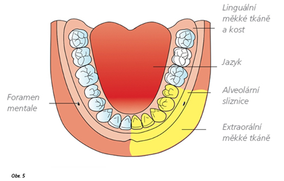 Je „mandibulární anestezie“ minulostí?: Zlepšení úspěšnosti anestezie v ...