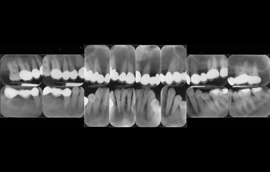 Multidisciplinární spolupráce při fixní rekonstrukci chrupu | StomaTeam, s.r.o. - Váš průvodce ...